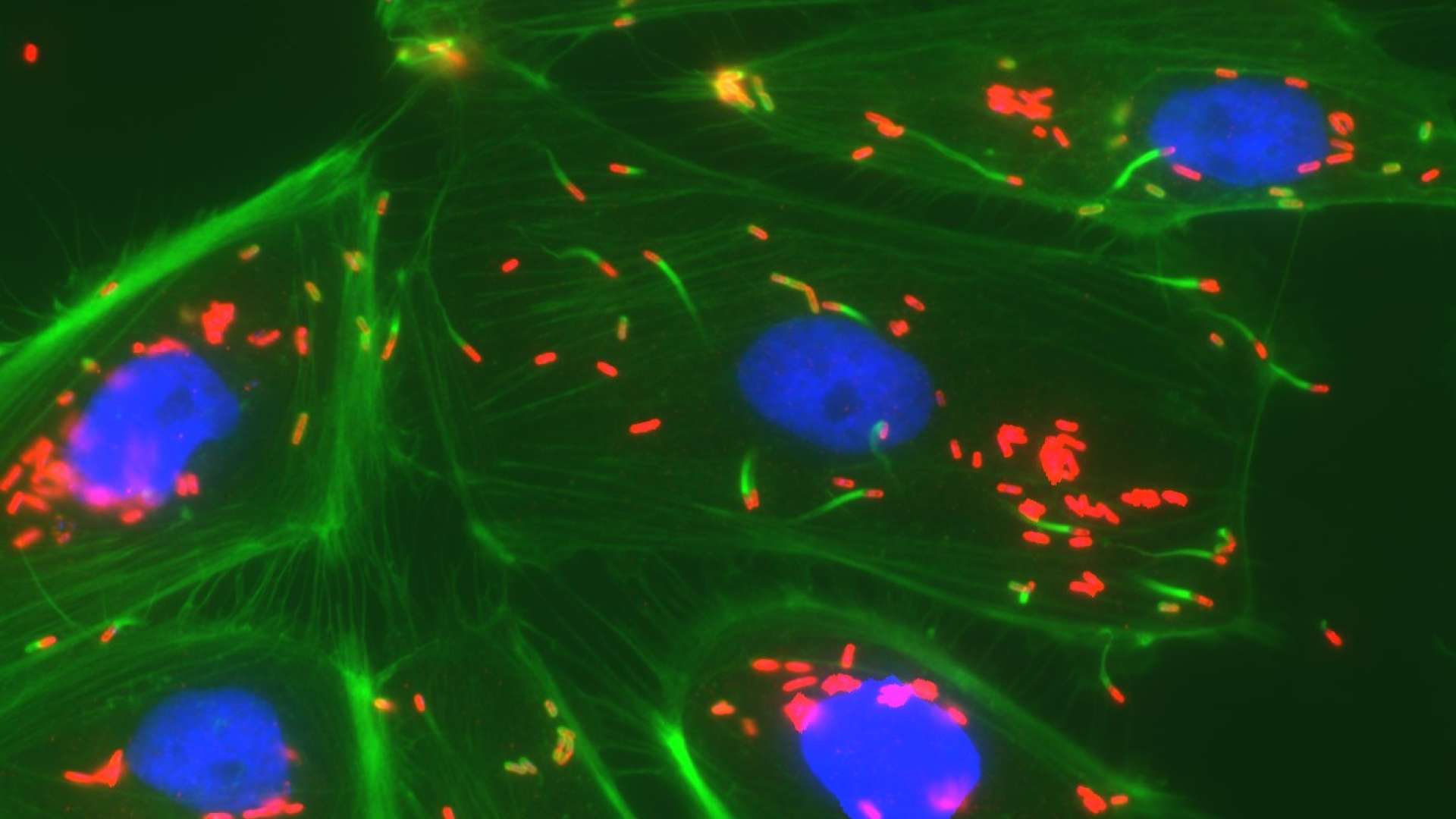 Voyage dans le monde incroyable des bactéries : beaucoup d'amies, peu d ...